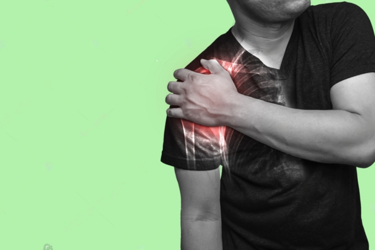 Shoulder Fracture Surgery in Quezon City - Tec Orthopedics