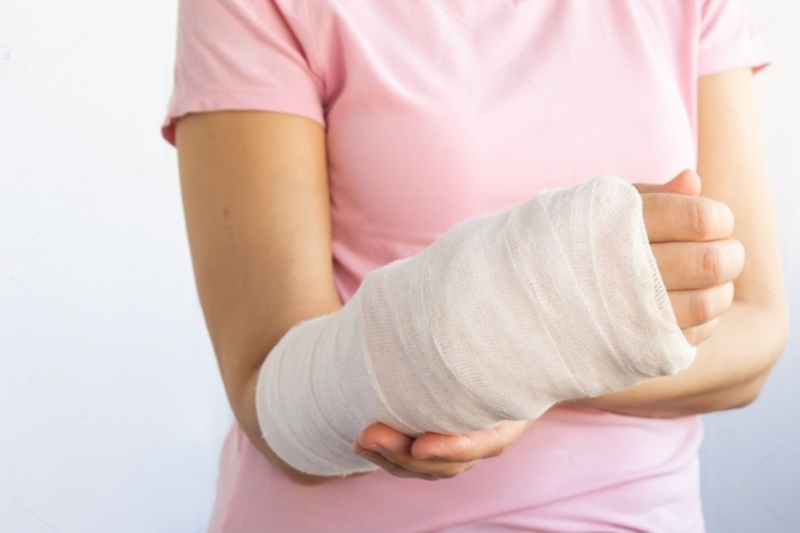 Wrist Casting in Quezon City - Tec Orthopedics