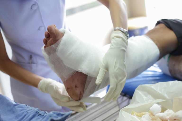 Orthopedic Treatment for Infected Wounds - Tec Orthopedics